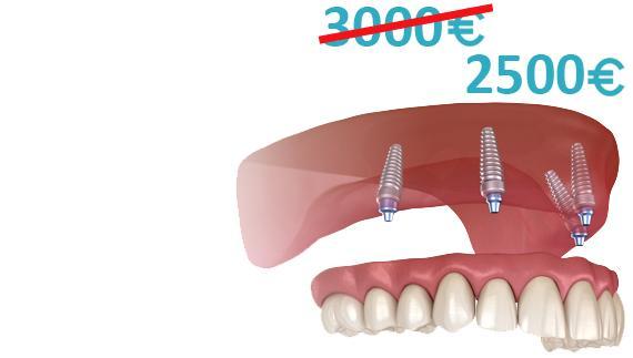 Sofia Implant Centre – All-on-4 Implants | All-on-6 | Same-day teeth | Complete mouth restoration