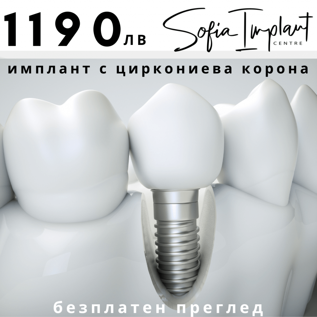 Дентални импланти в Турция – колко ниска е цената? – Sofia Implant Centre