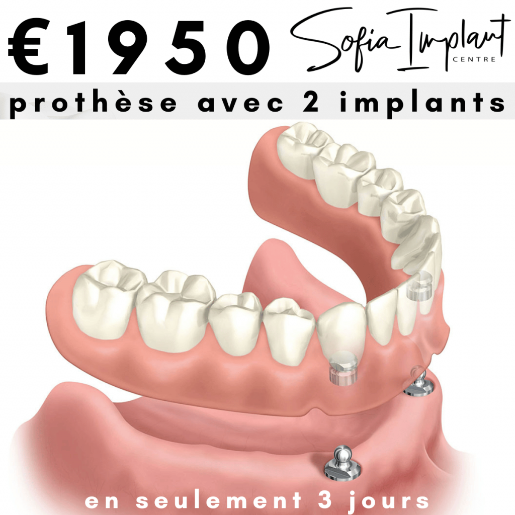 Prothèse avec 2 implants Offre 1950 € | Sofia Implant Centre – Sofia Implant Centre